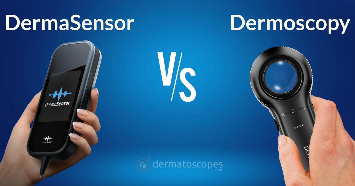 DermaSensor vs. Dermoscopy – Which Do You Need? | Dermatoscopes.com