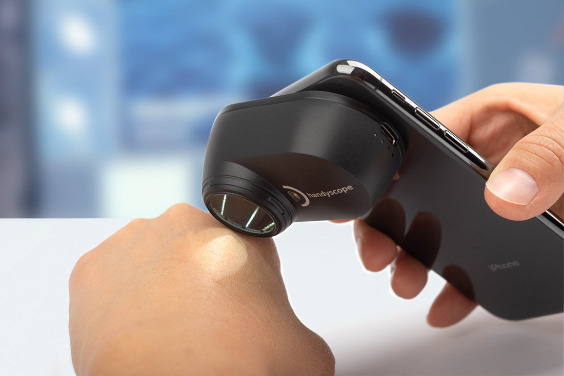 Photo Dermoscopy | Dermatoscopes.com