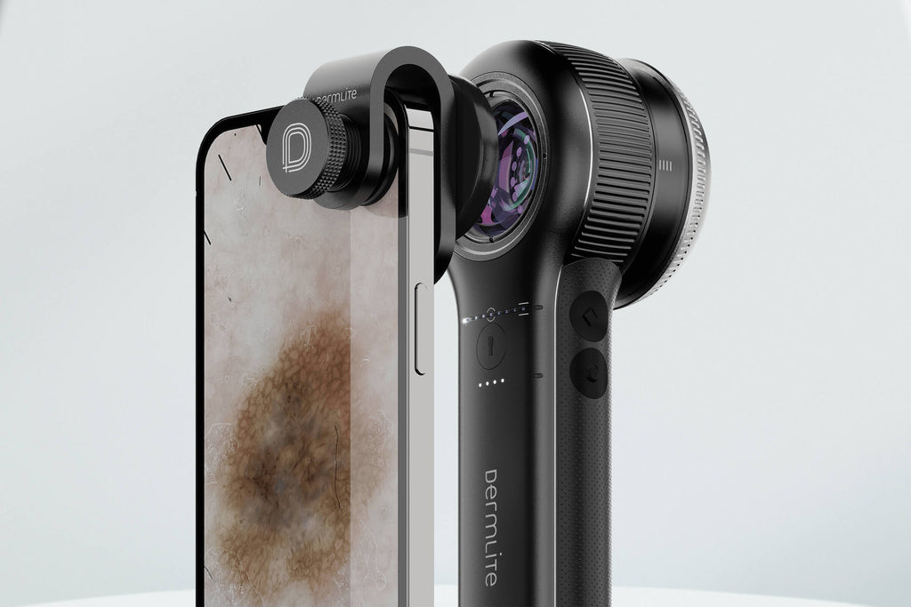 Dermlite DL5 | Dermatoscopes.com
